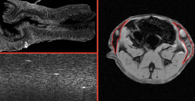 Collagen imaging: Bridging the gap between microscopy and the clinic ...
