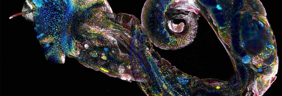 Finding a weak link in the frightful parasite Schistosoma | Morgridge ...